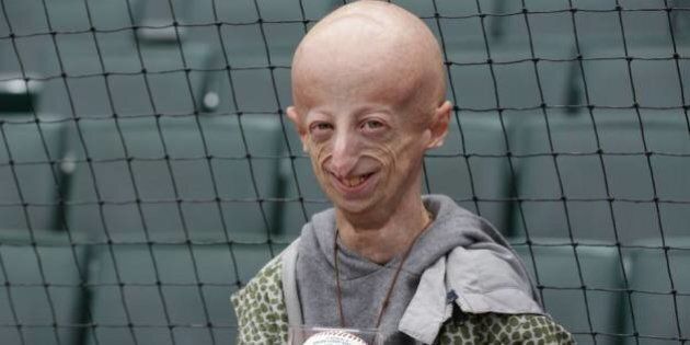 Sammy Basso: "Sono grato alla progeria, non cambierei una virgola della ...