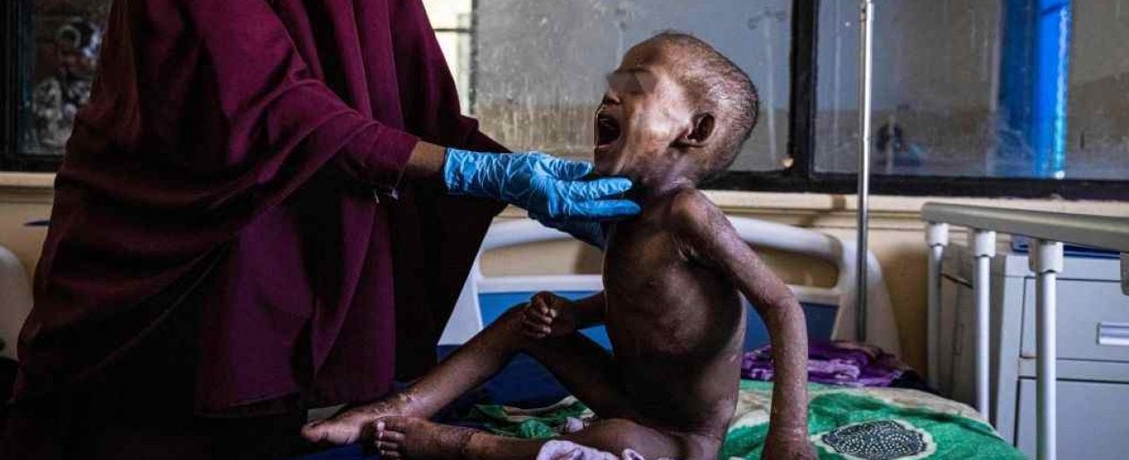 È arrivato il momento che la fame in Africa torni a essere notizia ...