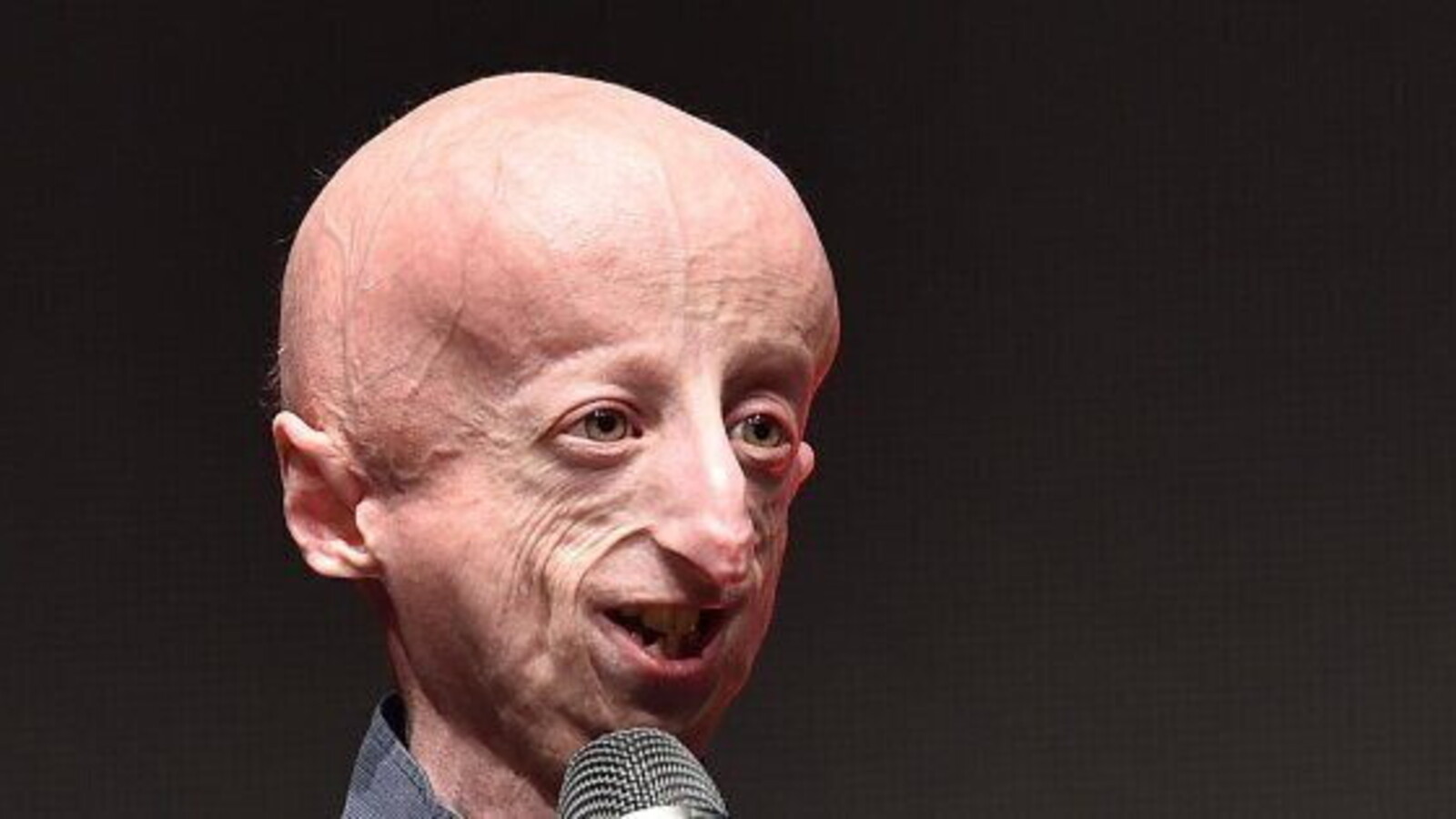 È morto Sammy Basso, fondatore dell'associazione Progeria - HuffPost Italia