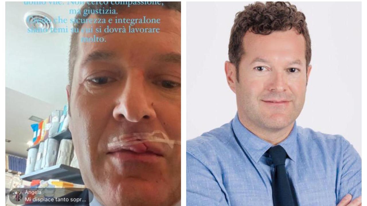 Aggredito e ferito l’avvocato Alessandro Reale candidato consigliere a ...