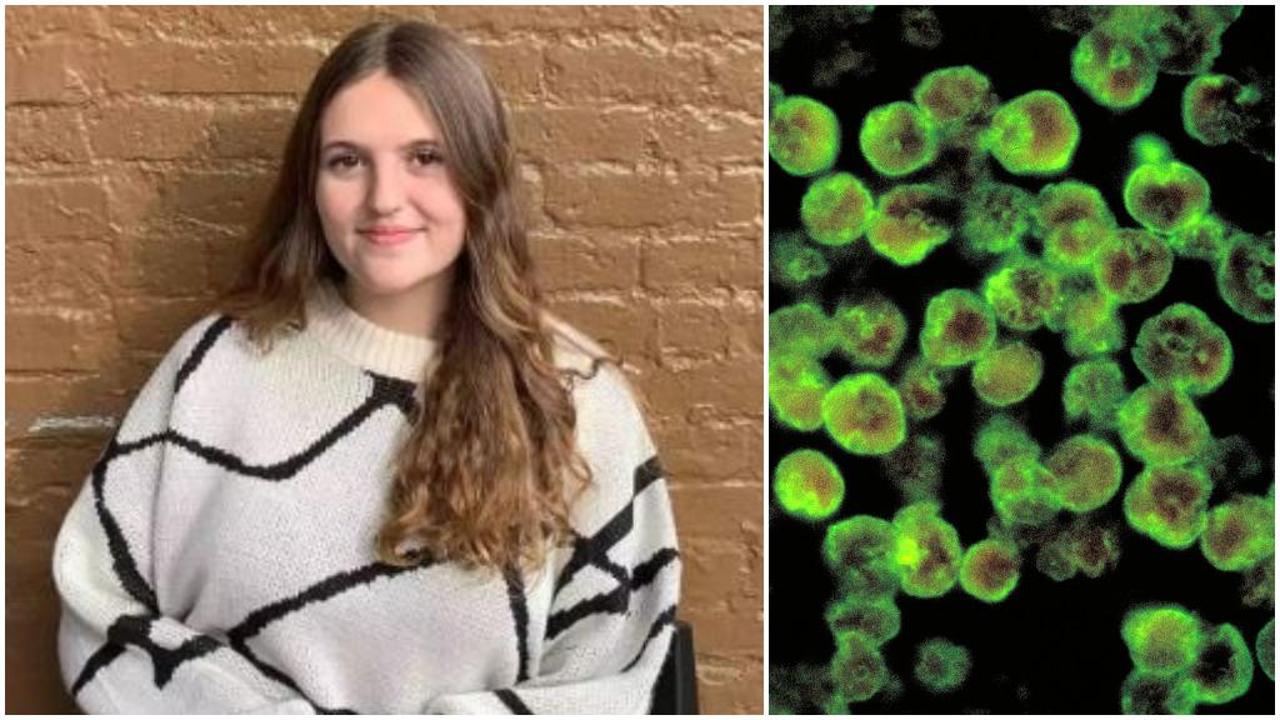Ameba mangia cervello uccide 17enne in Georgia dopo bagno in un lago ...