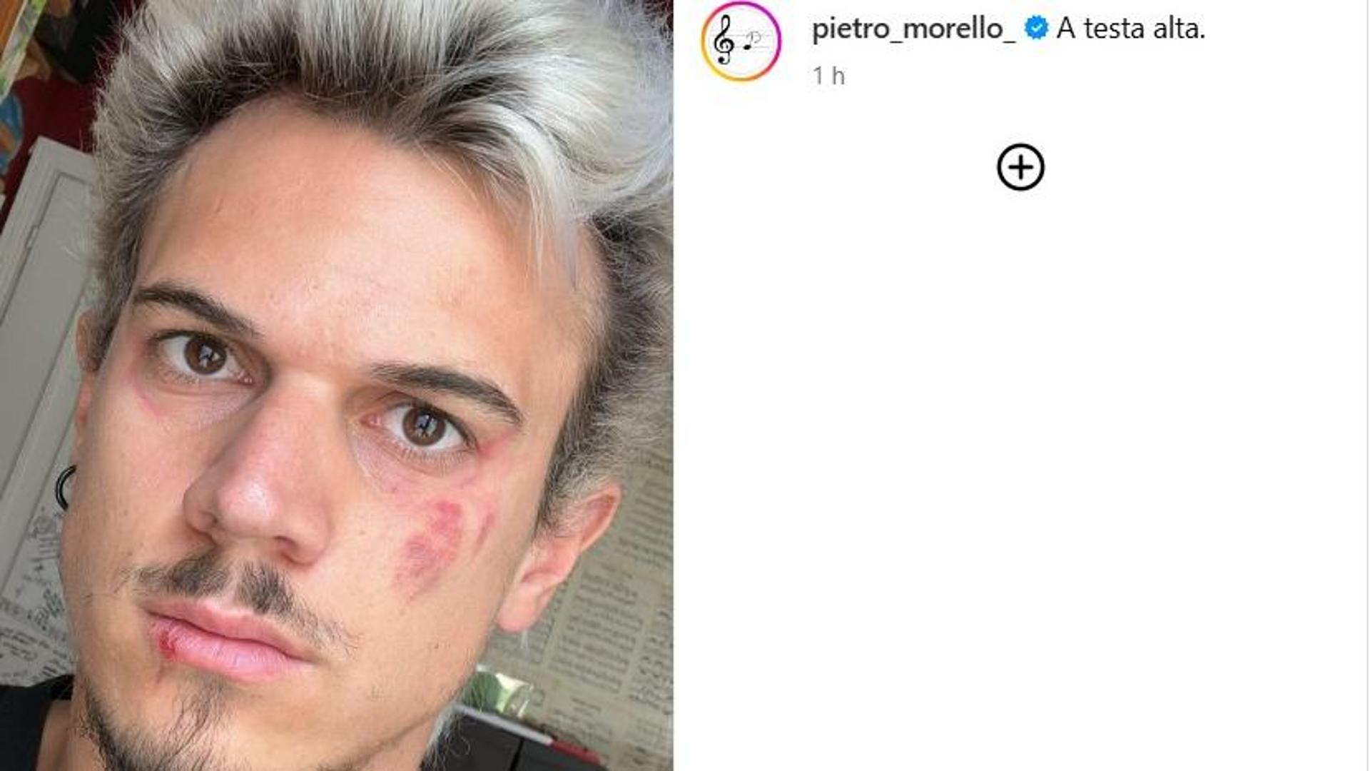 Il musicista influencer torinese Pietro Morello aggredito per strada ...