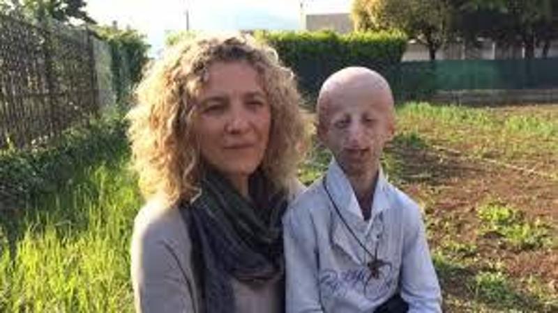 Sammy Basso, la mamma "Ci ha insegnato che la felicità è ovunque” - La ...