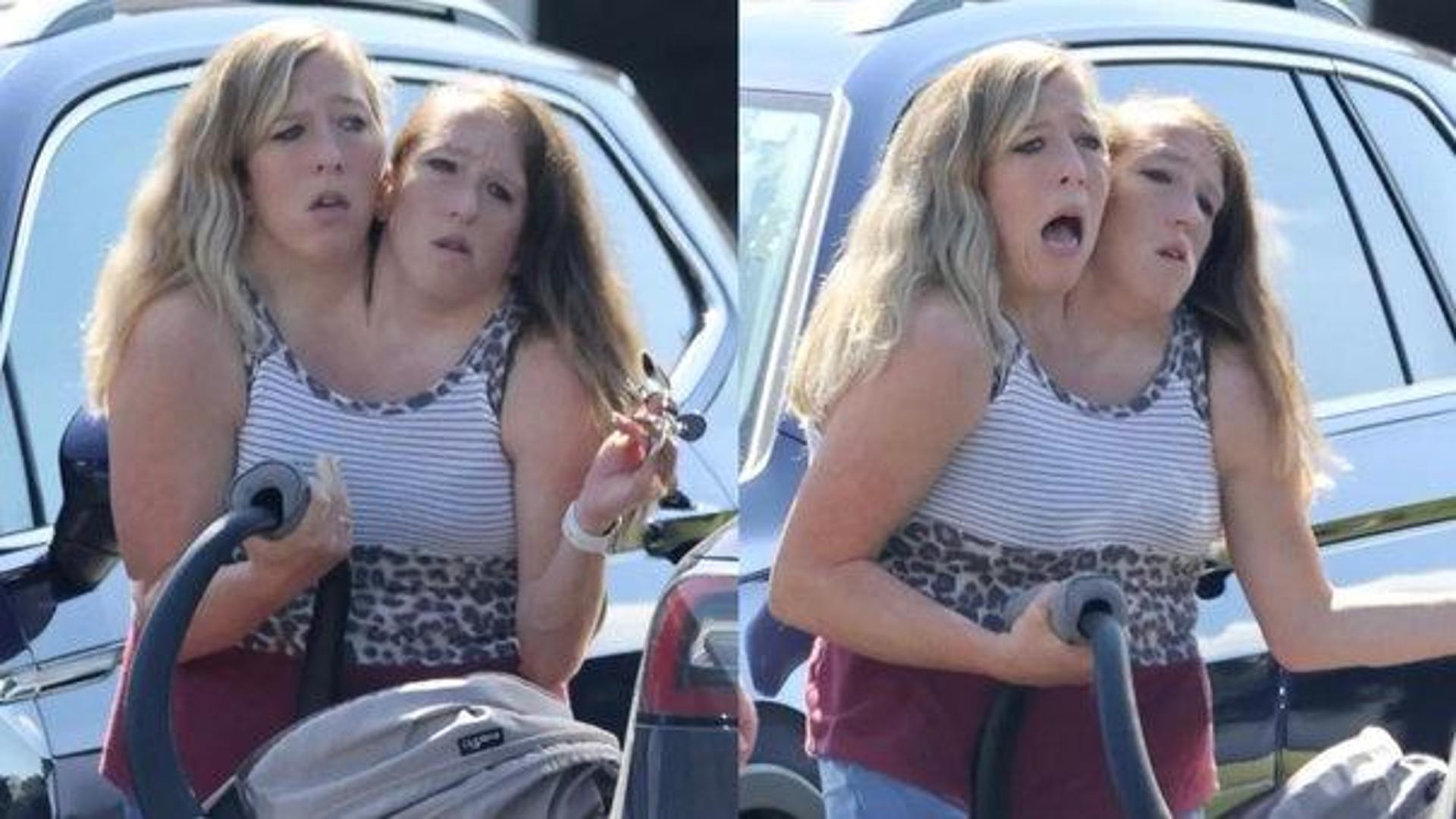 Le gemelle siamesi con due teste e un corpo diventano mamme - La Stampa